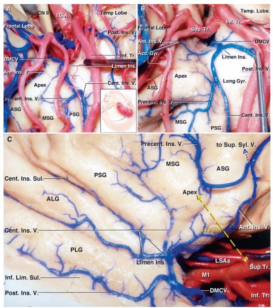 Sylvian Fissure Anatomy