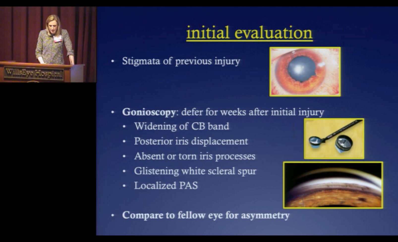 Iris Processes Gonioscopy