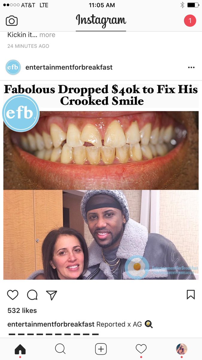 Natalie Nunn Chin Reduction