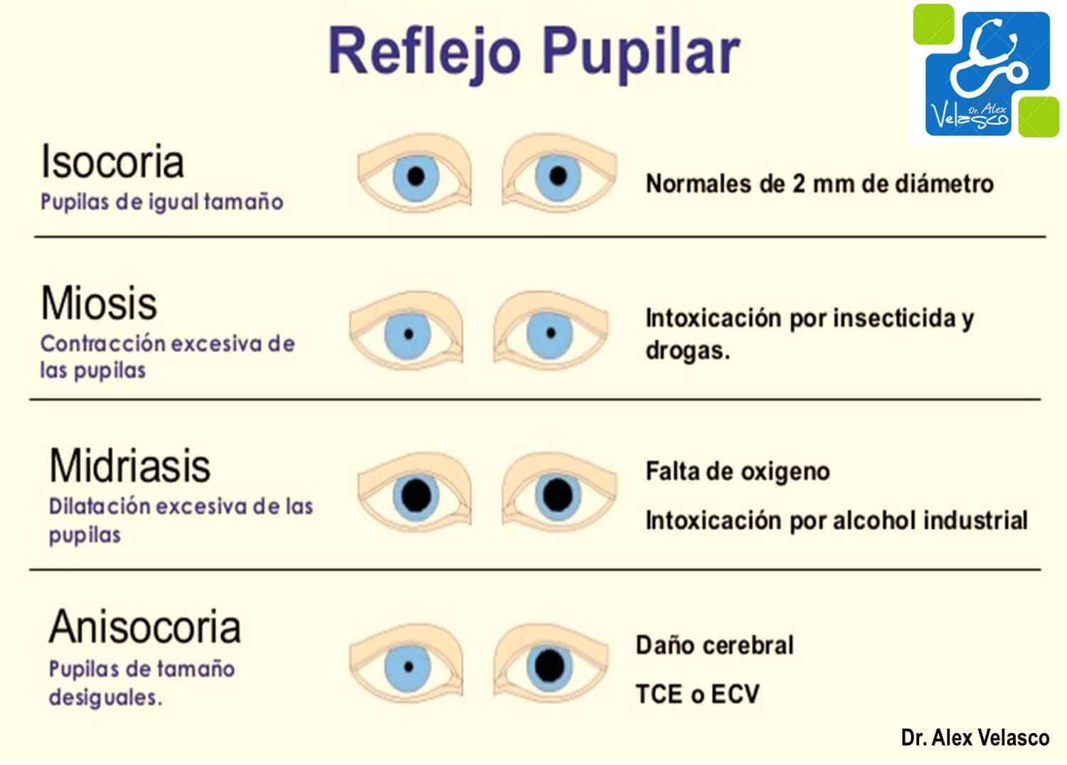 Miosis Y Midriasis