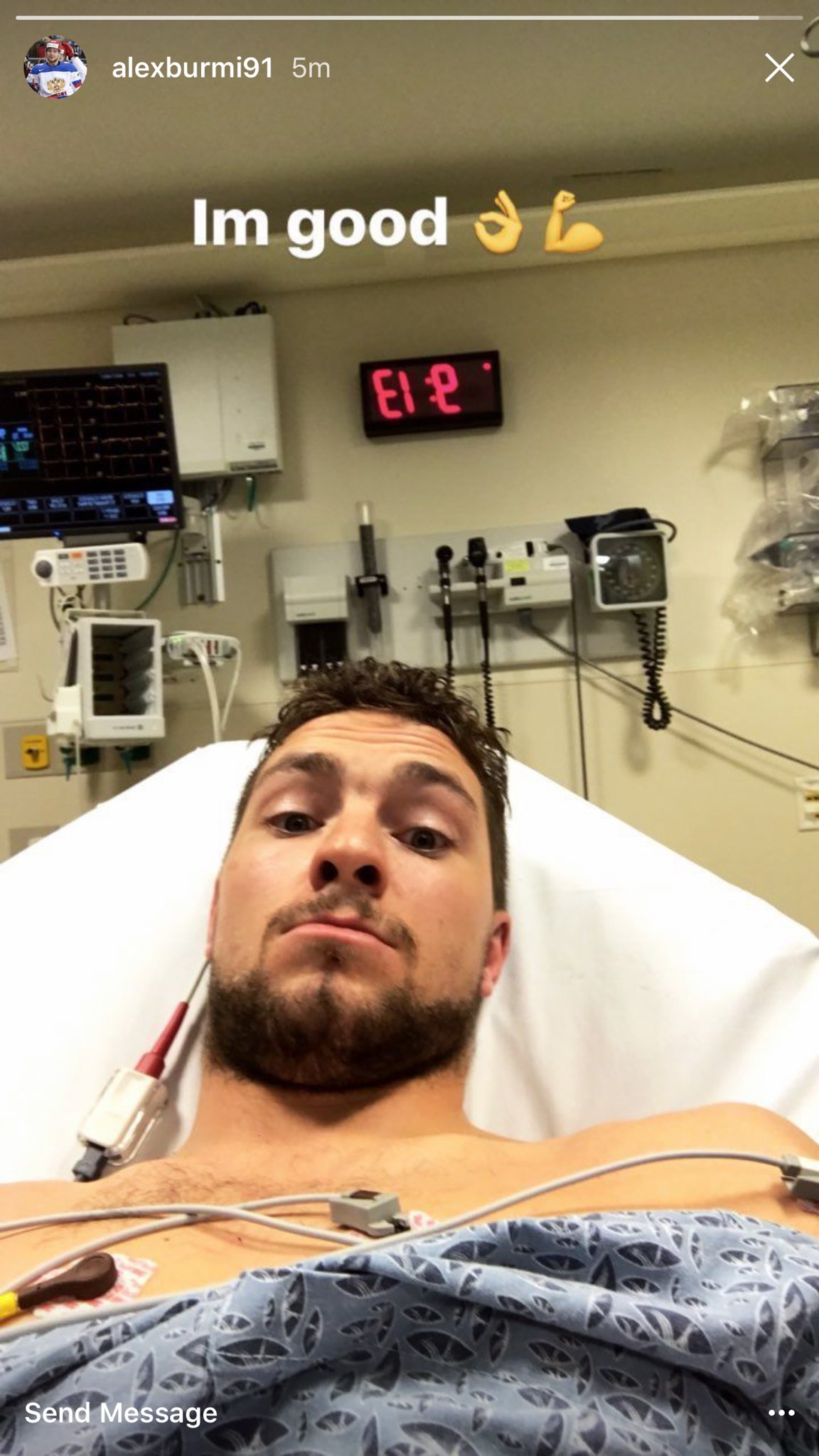 Burmistrov "I'm ok!" : r/BostonBruins