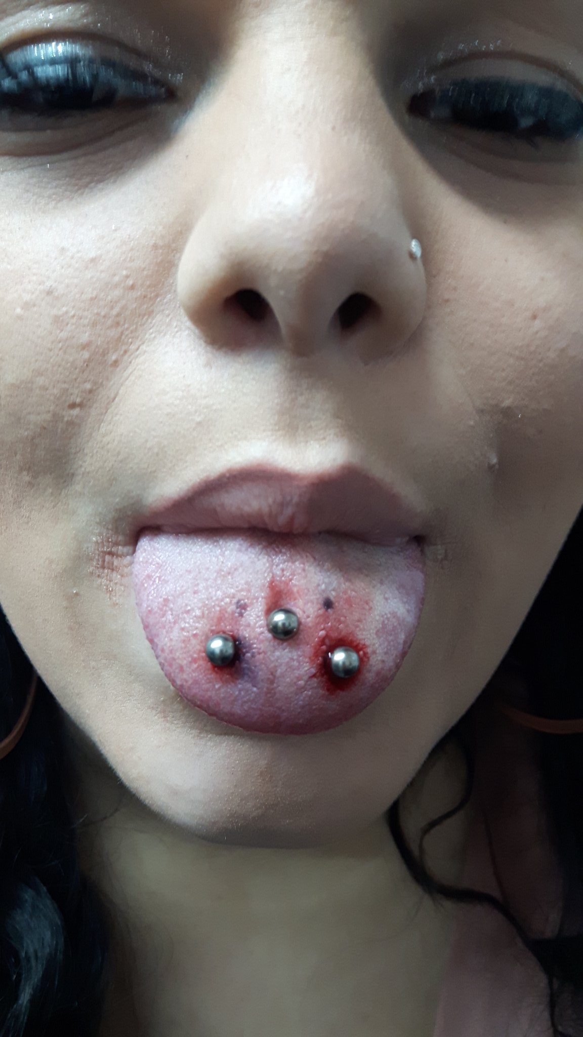Surface Tongue Piercing