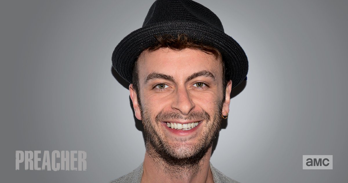 Joseph Gilgun Teeth