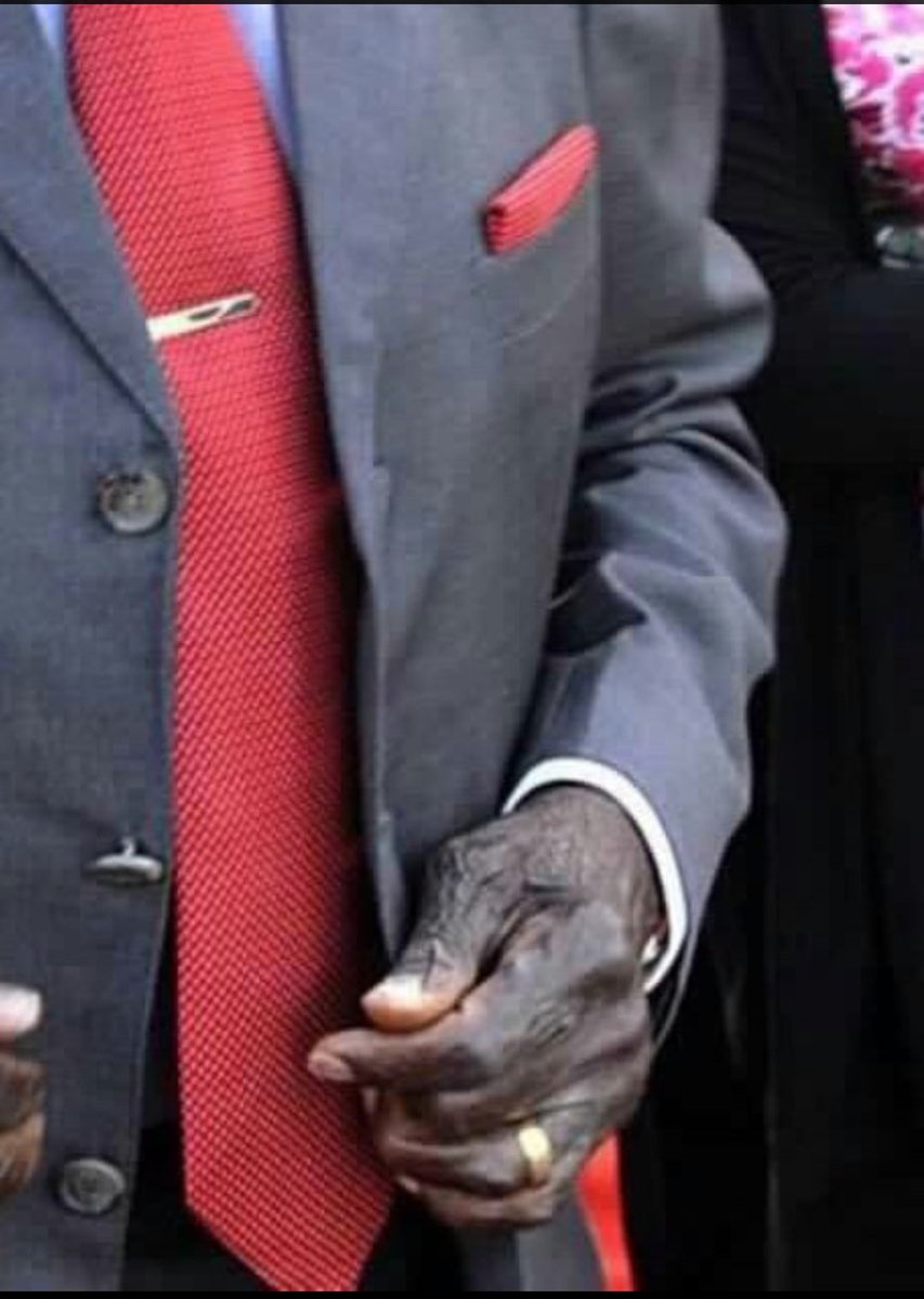 Mugabe’s Skin Shrivels | NOW DAILY