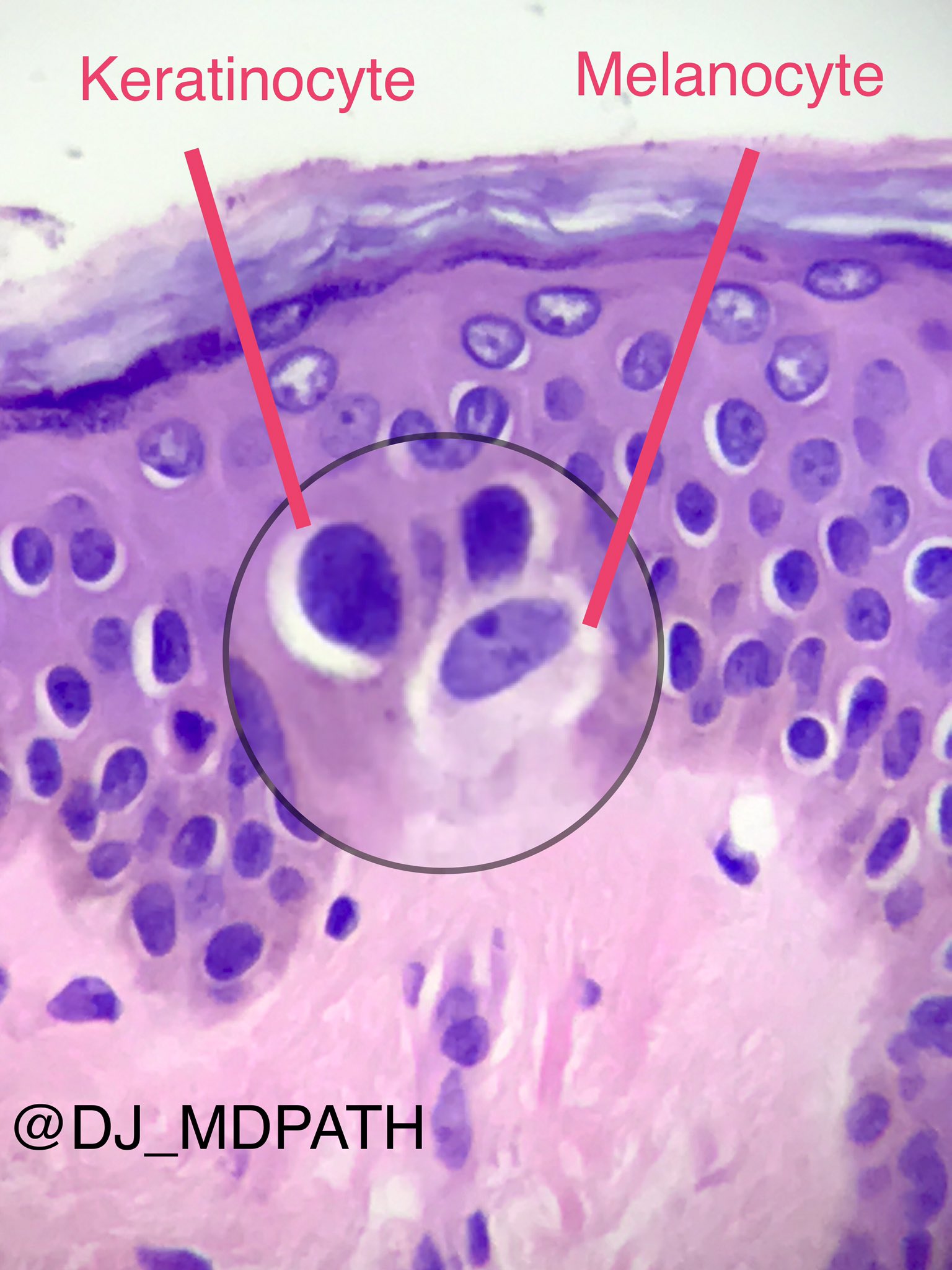 Keratinocyte Histology