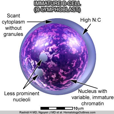 Lymphoblast Vs Myeloblast