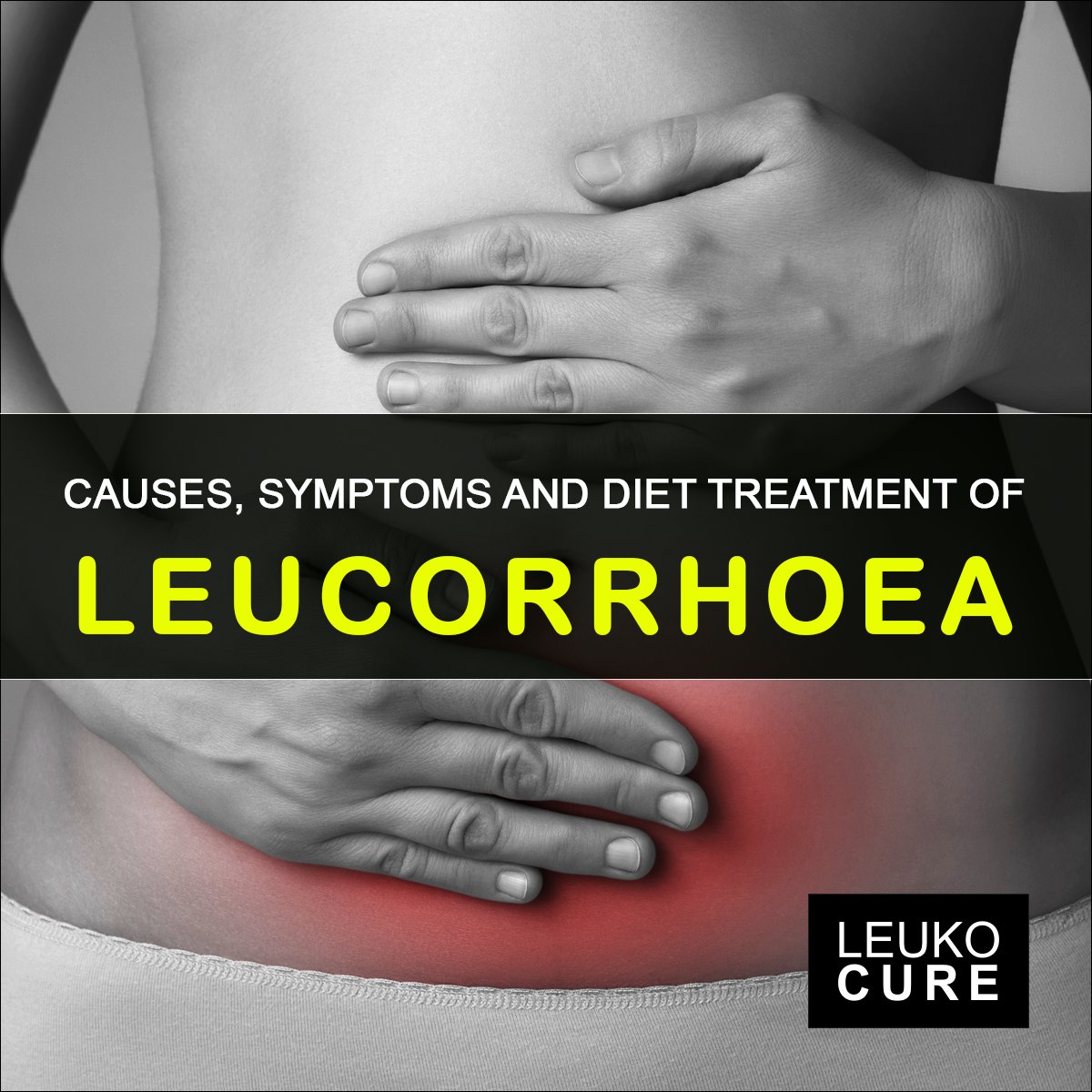 Leucorrhea Causes