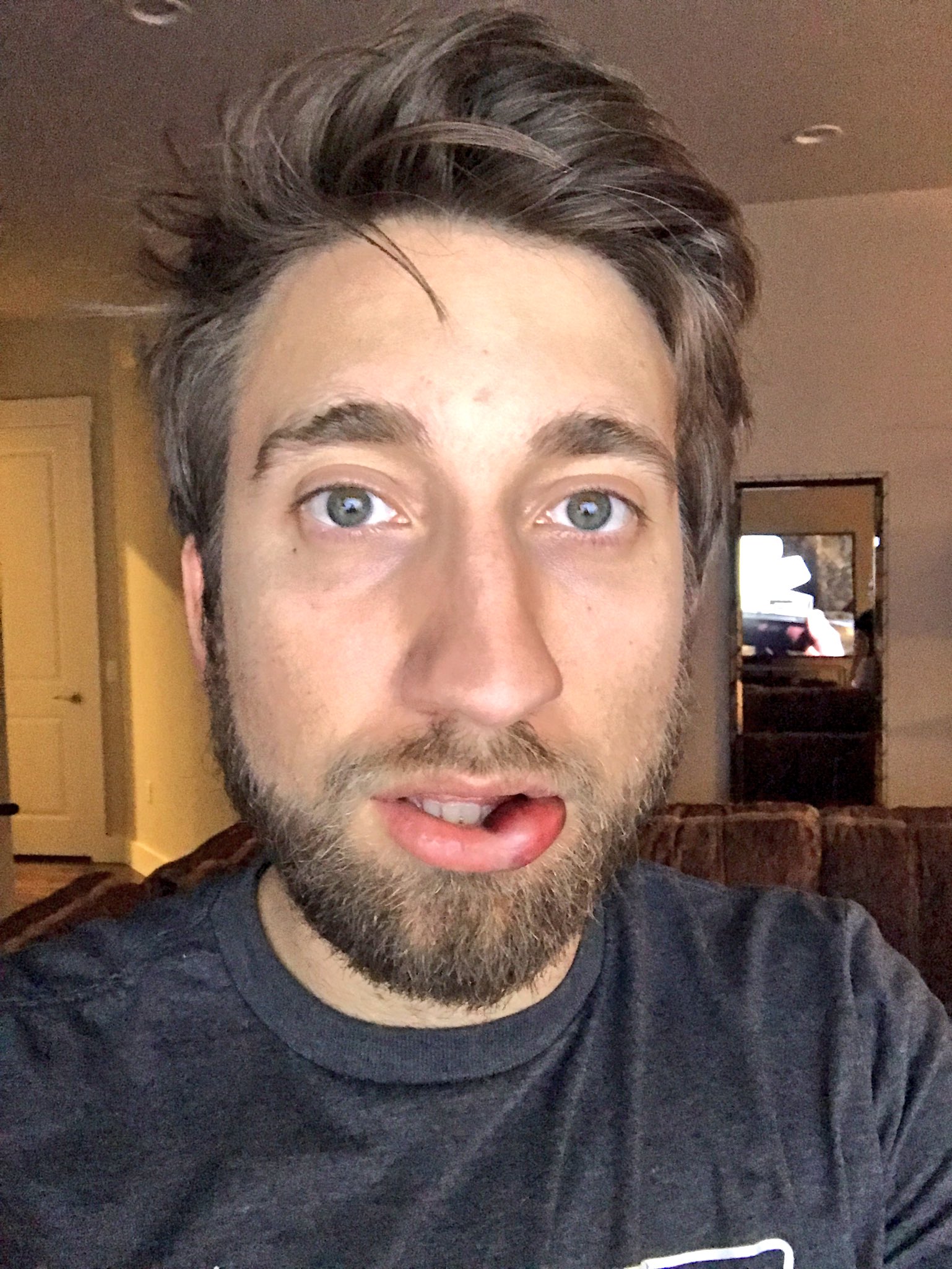 Gavin Free Nose
