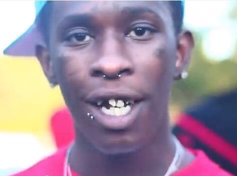 Young Thug The Rapper Teeth Rappers Ditched Their Grills For Really