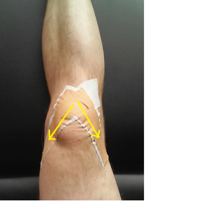 Kt Tape Heel Fat Pad at Greg Howell blog