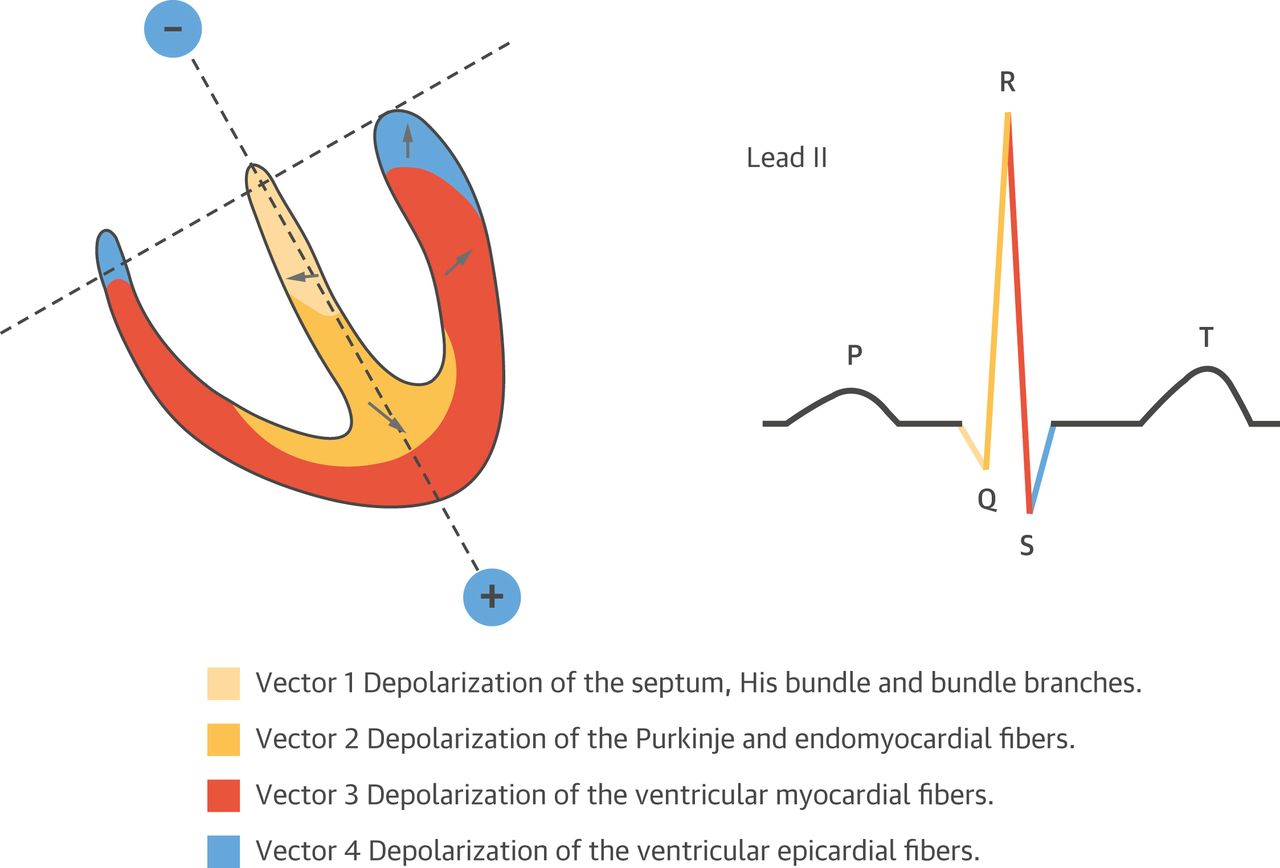 Ventricular Hypertrophy Anatomy, Function, And Dysfunction Of The RV