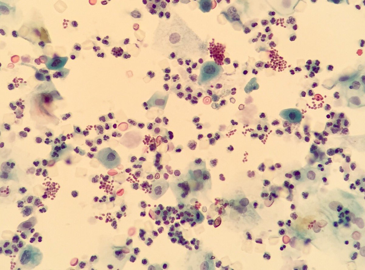 Candida In Urine