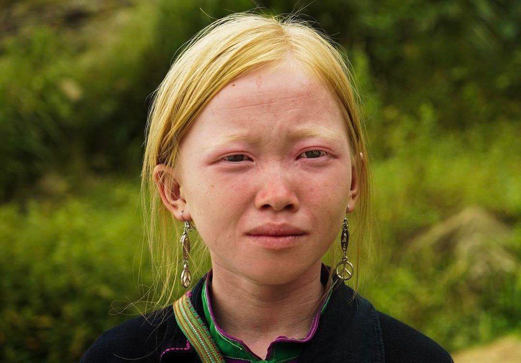 Mongolian People Blue Eyes