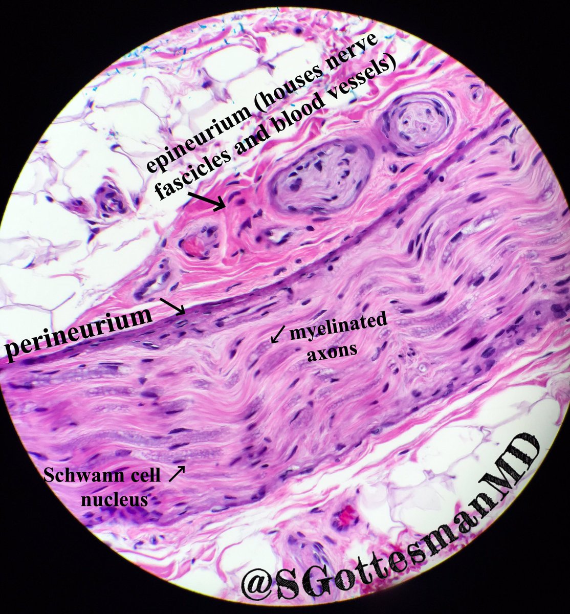 Schwann Cells Histology