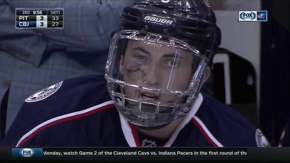 Zach Werenski: Blue Jackets’ Zach Werenski took puck to face, got ...