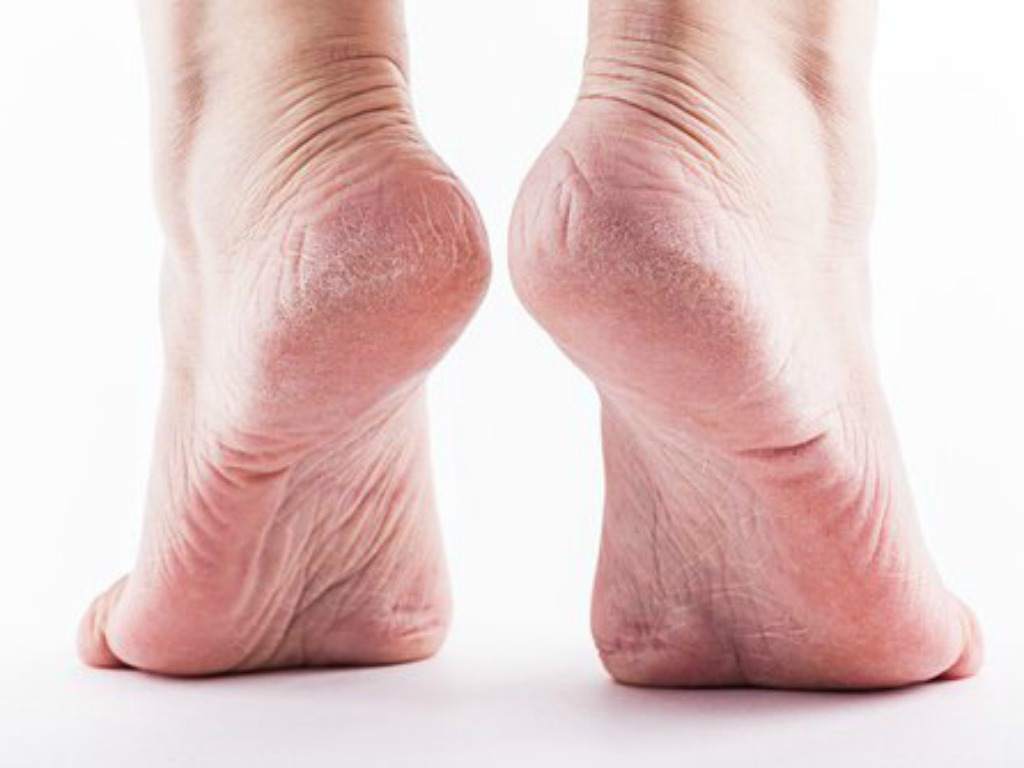 ¿Tienes los pies maltratados, con callos y durezas? Aquí esta la ...