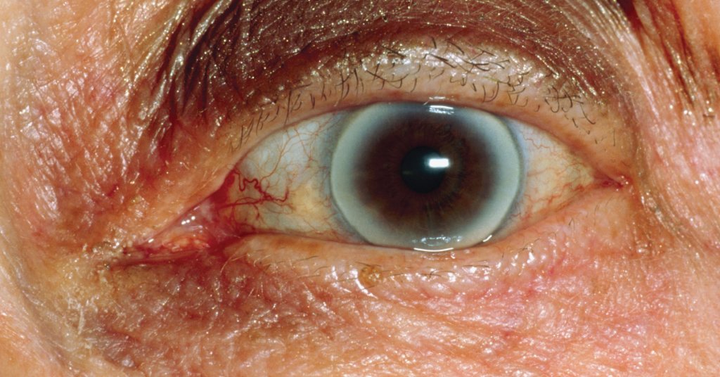 arcus : Latest news, Breaking news headlines | Scoopnest