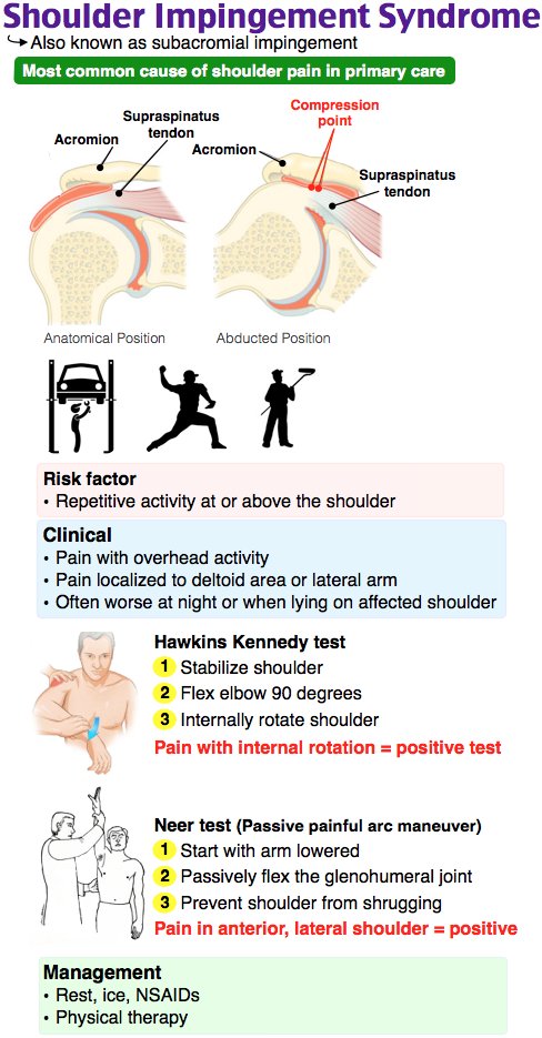 Shoulder Impingement Syndrome Test