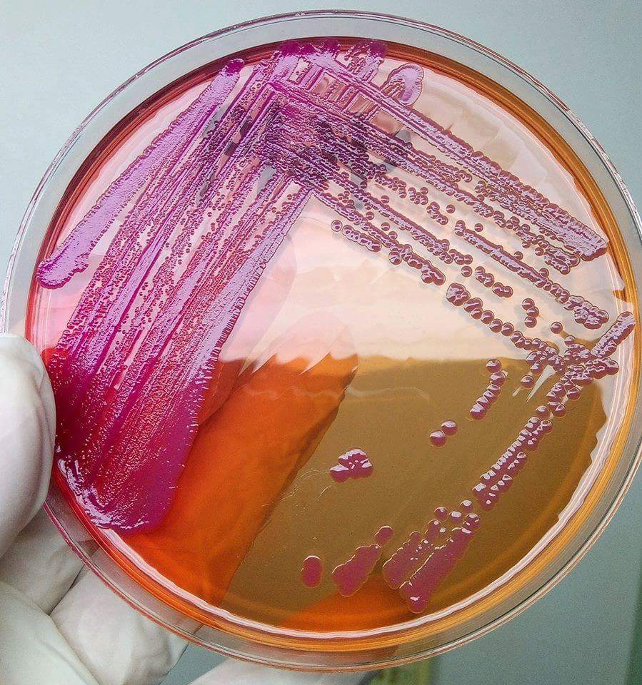 Acinetobacter On Macconkey Agar