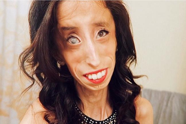 Ugliest Woman Lizzie