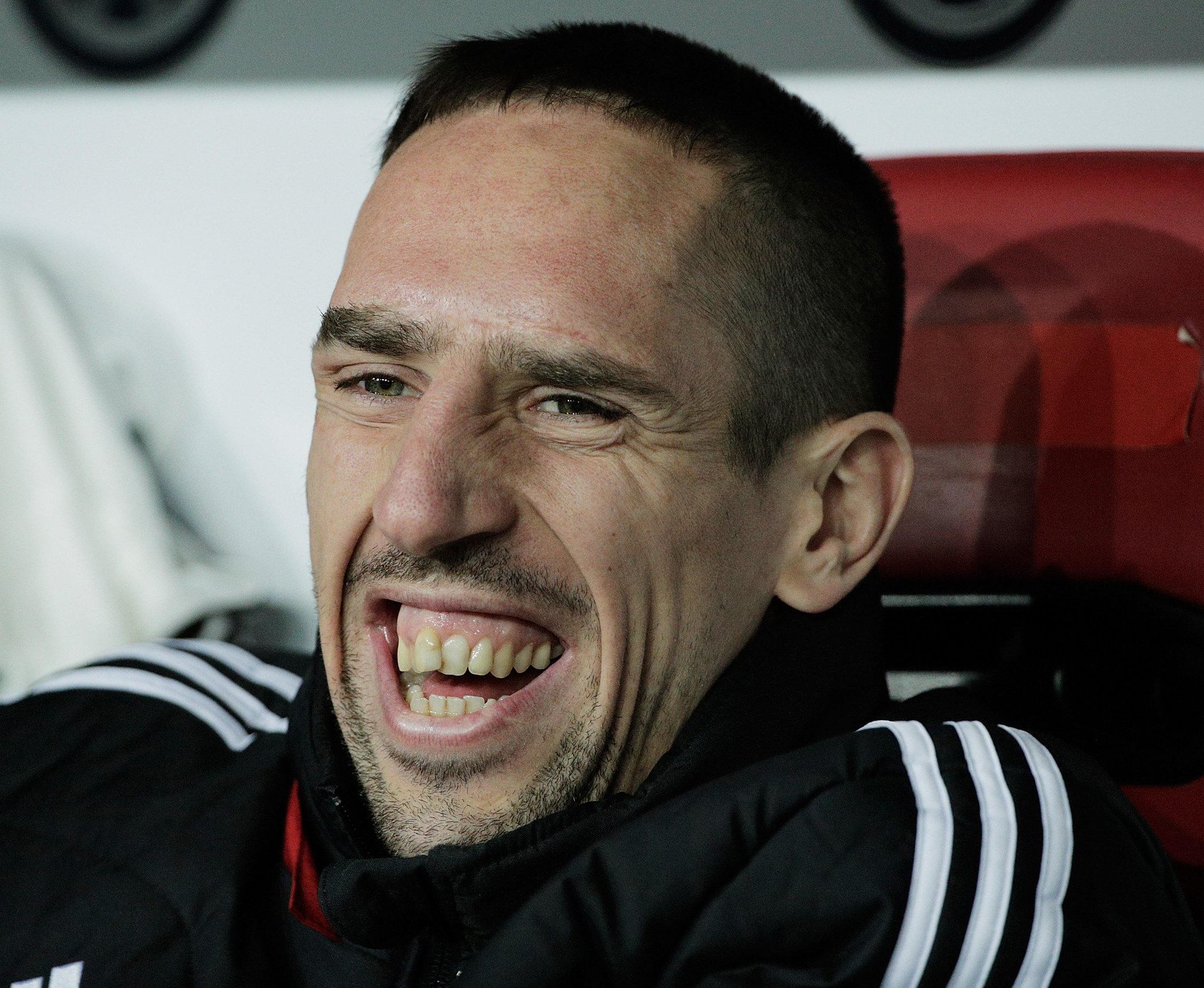Ribery Teeth