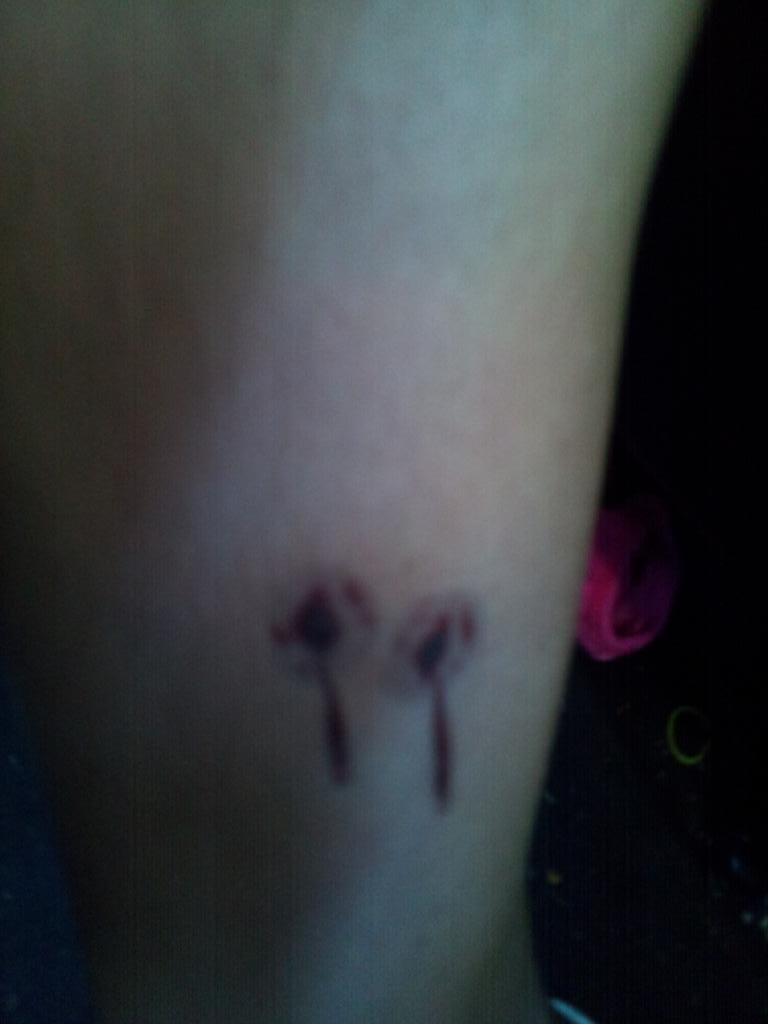 Vampire Bite Tattoo On Wrist