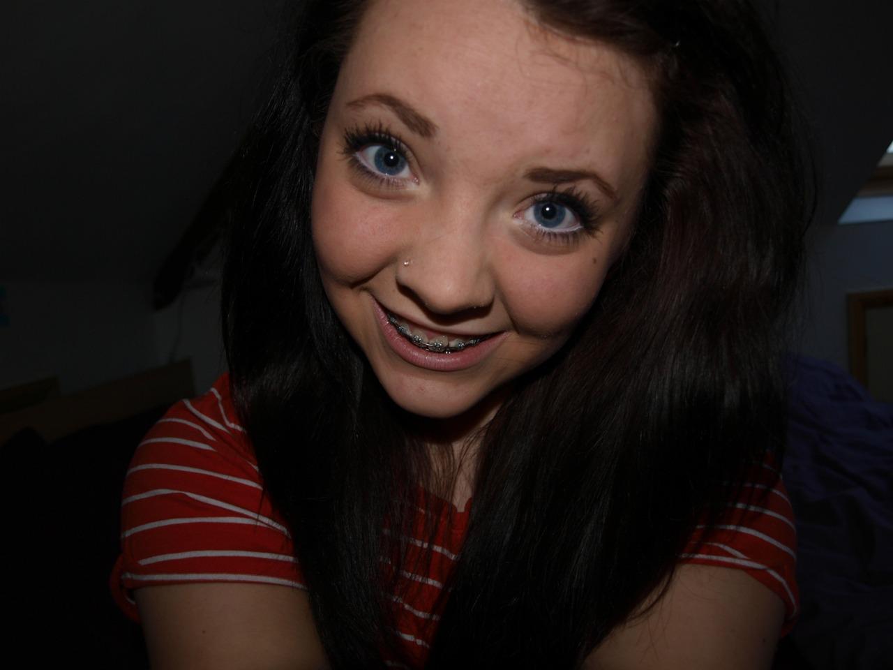 Girls With Braces On Twitter Looking Cute In Her Striped Shirt