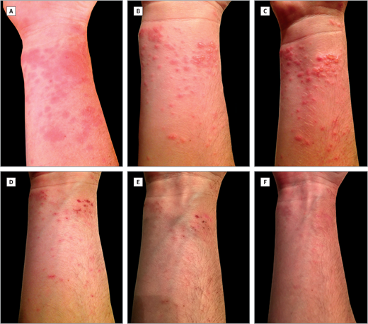 Can Moon Jellyfish Sting