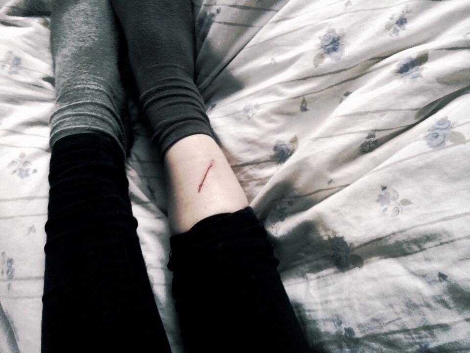 Cut Arm Tumblr