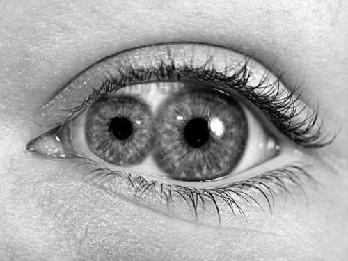 People With Two Pupils In One Eye
