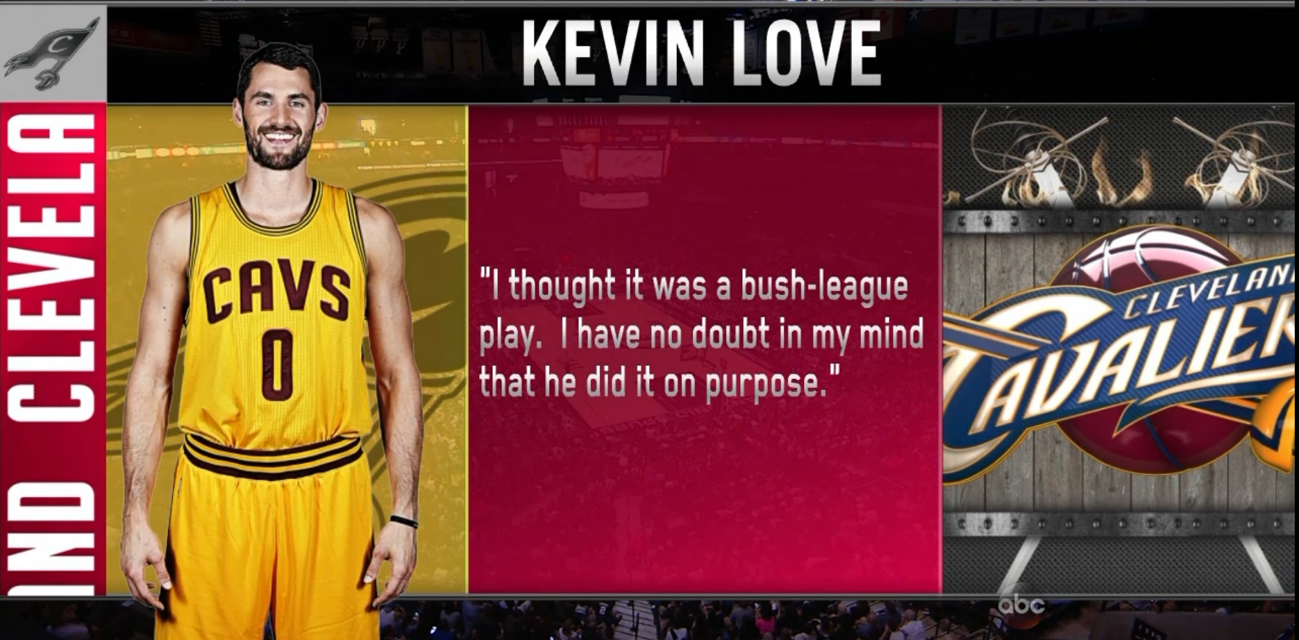 Kevin Love Shoulder