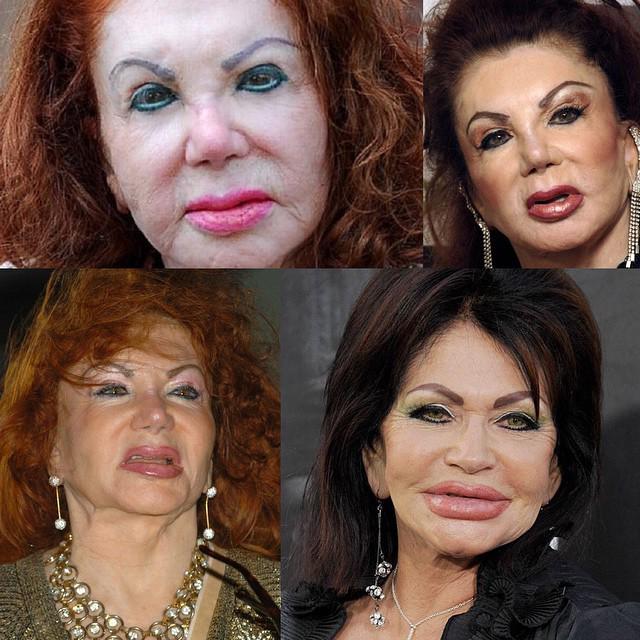 Sylvester Stallone Mother Before And After