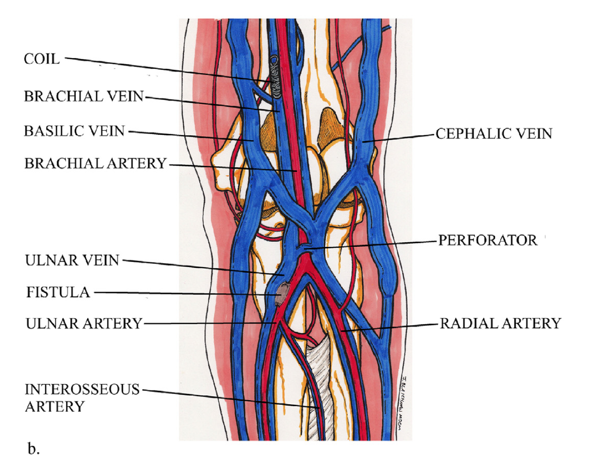 Brachial Artery And Vein