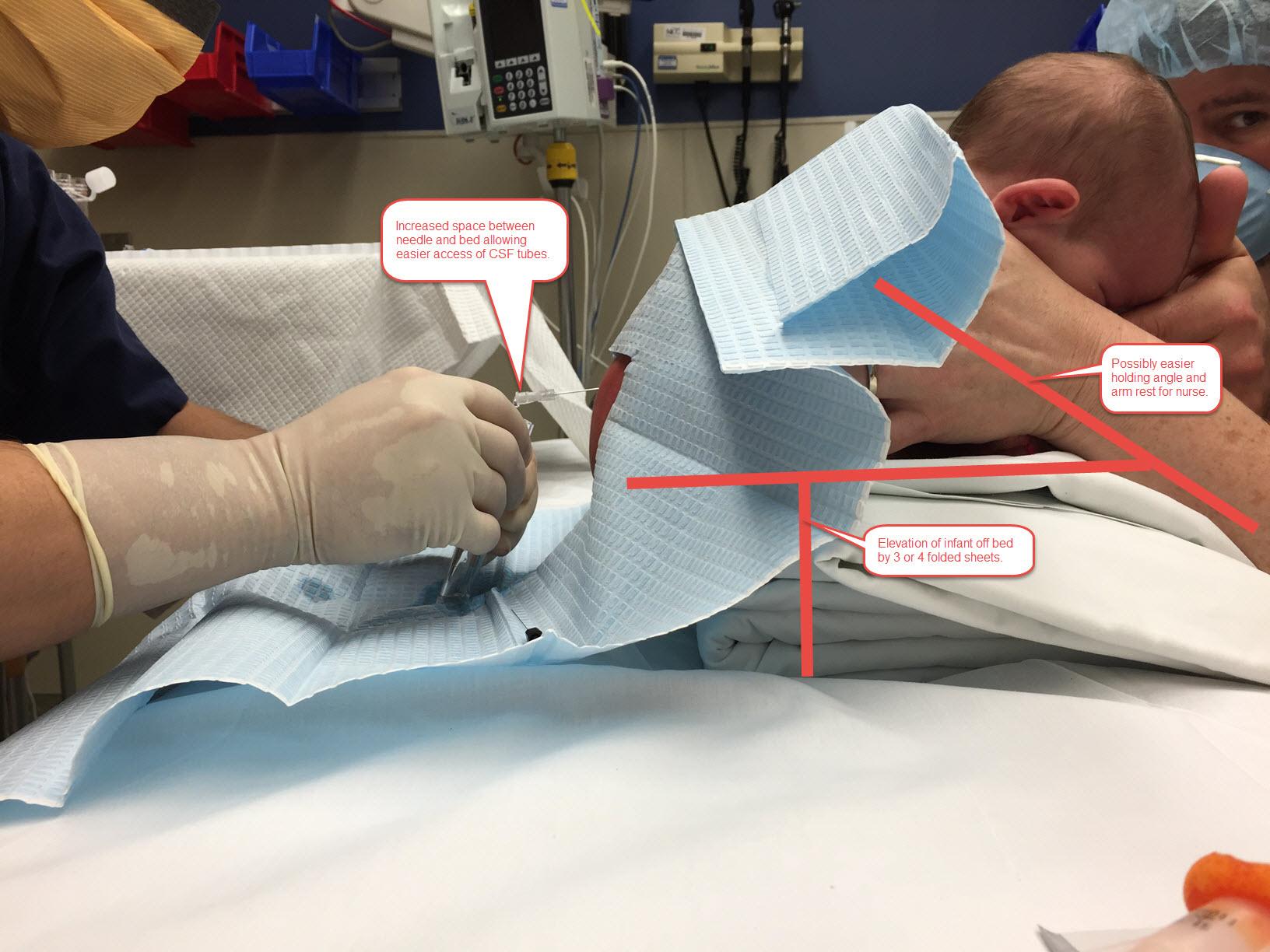 Lumbar Puncture Baby Medical Research And Resources On Infant Spinal