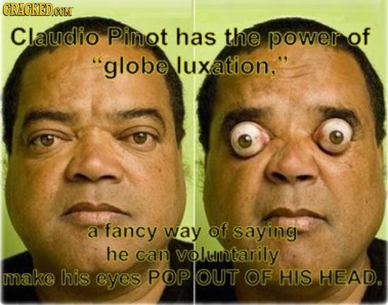 Globe Luxation: "Globe Luxation" and 17 More Mutant Superpowers You Won ...