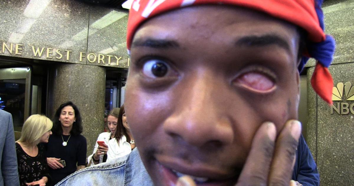 FINALLY! The FULL story of how TrapQueen rapper Fetty Wap lost his eye ...