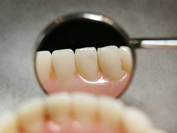 British People Teeth