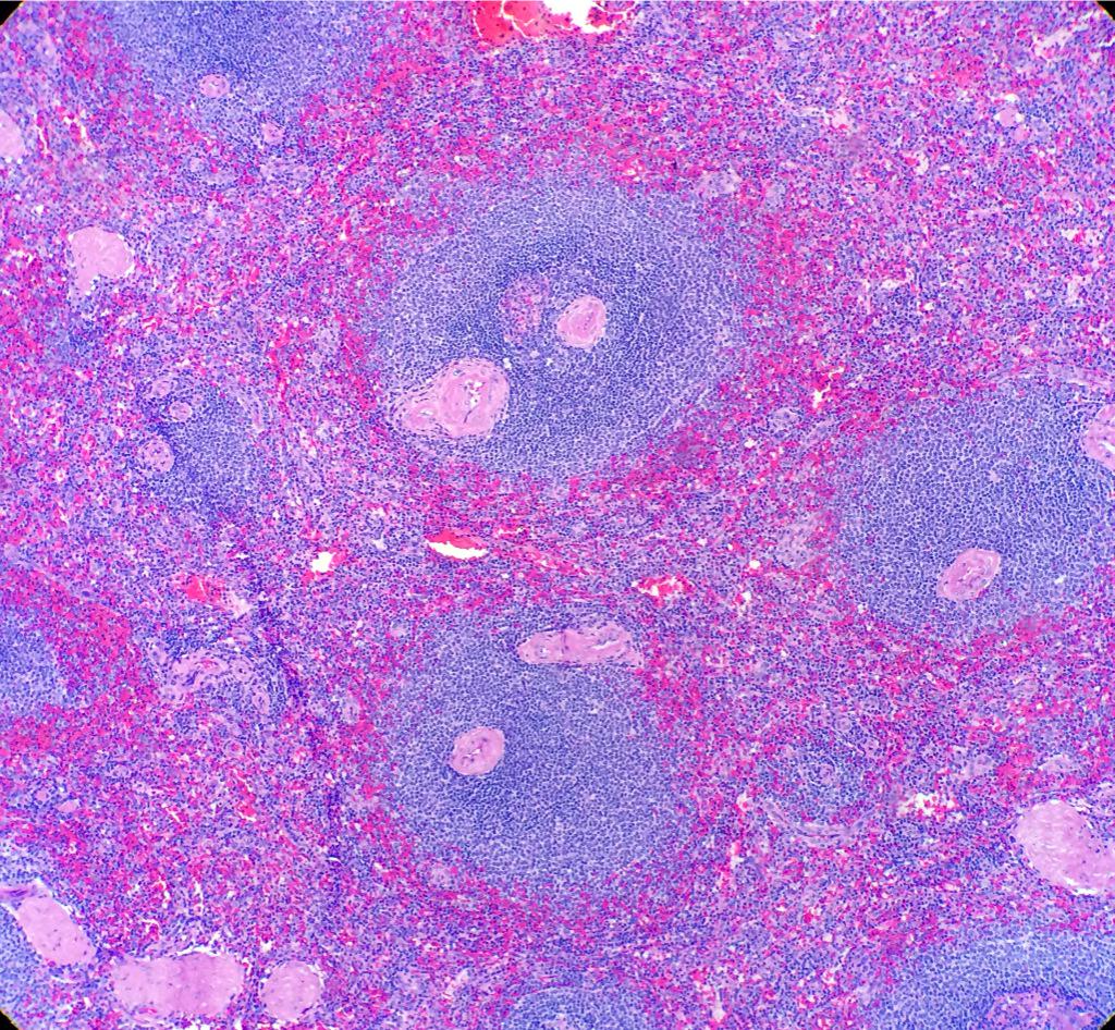 Spleen Histology White Pulp