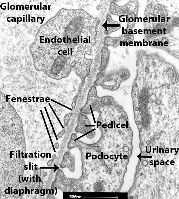 Glomerular Basement Membrane Em