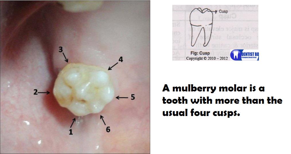 Mulberry Molars