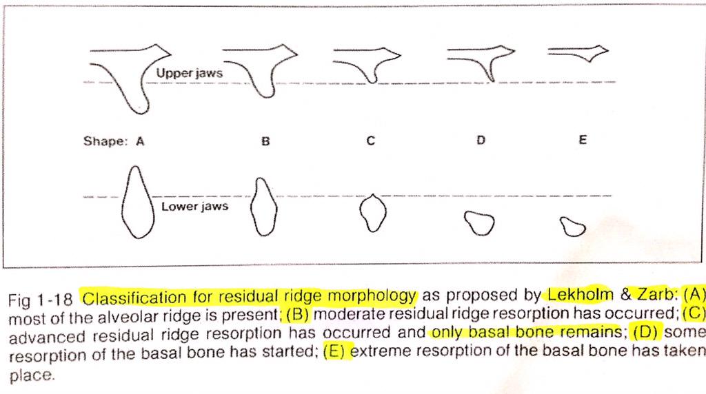 Residual Ridge
