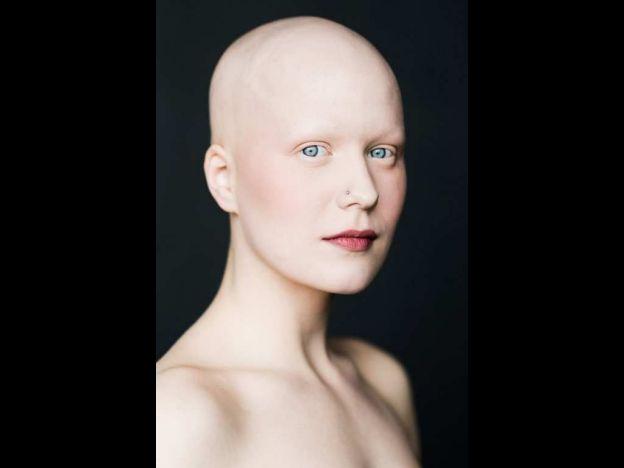 #fotos siete mujeres sin cabello se dejan retratar y muestran al mundo ...