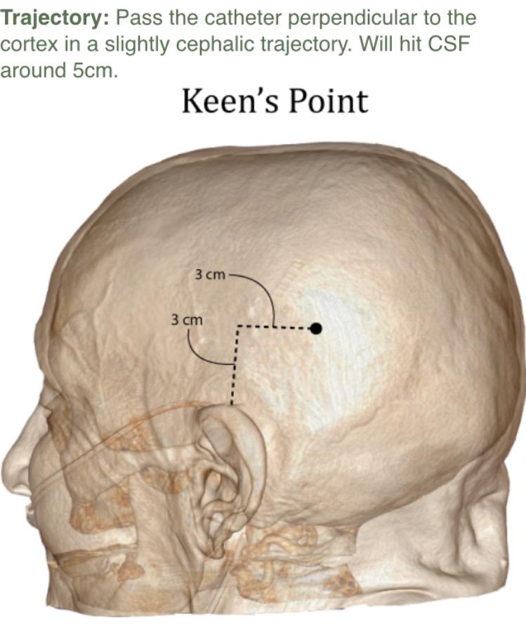 Abdulaziz Almubarak On X: Different EVD Entry Koher's, 56% OFF
