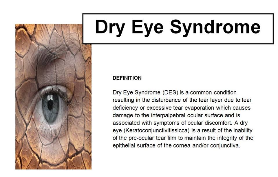 Keratoconjunctivitis Sicca