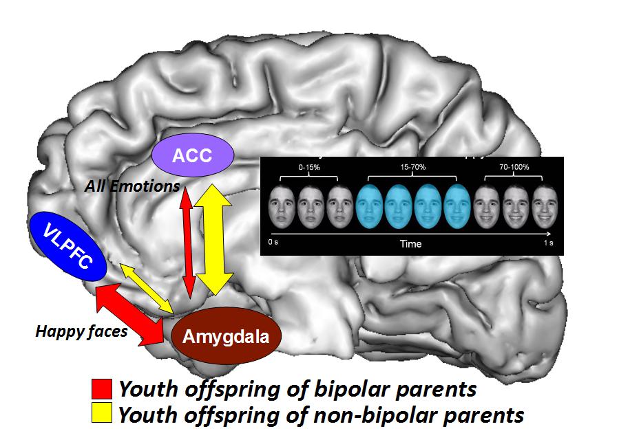 Bipolar Brain In Diagram