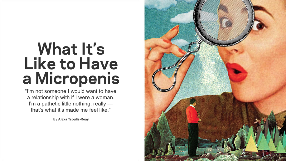 This is what it's like to have a micropenis: #nymagarchive - scoopnest.com