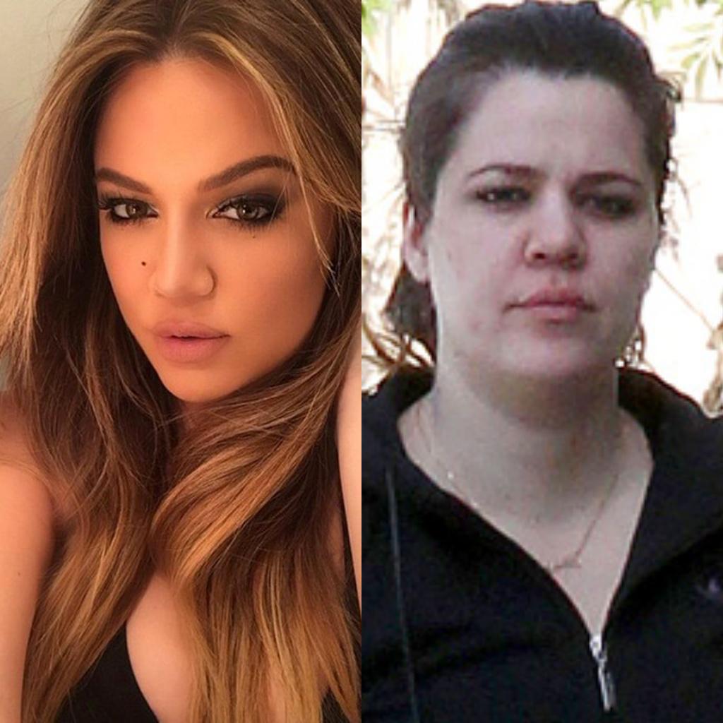 Khloe Kardashian Plastic Surgery Before And After