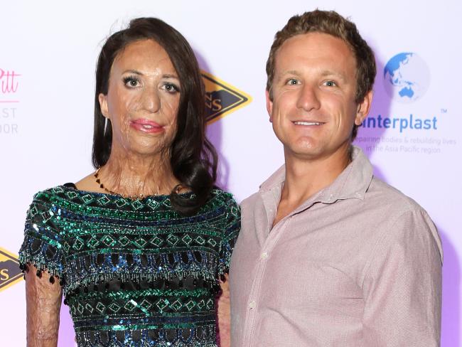 Inspirational burns victim Turia Pitt engaged to long time boyfriend ...