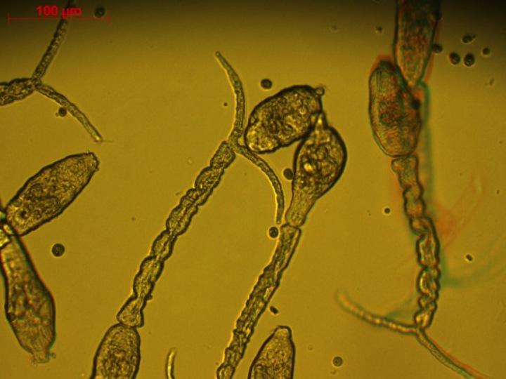 Schistosoma Haematobium