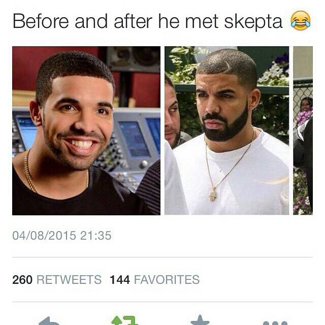 Drake Before And After